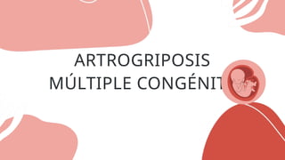 ARTROGRIPOSIS MÚLTIPLE CONGÉNITA GENETICA.pptx