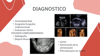 ARTROGRIPOSIS MÚLTIPLE CONGÉNITA GENETICA.pptx