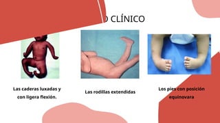 ARTROGRIPOSIS MÚLTIPLE CONGÉNITA GENETICA.pptx