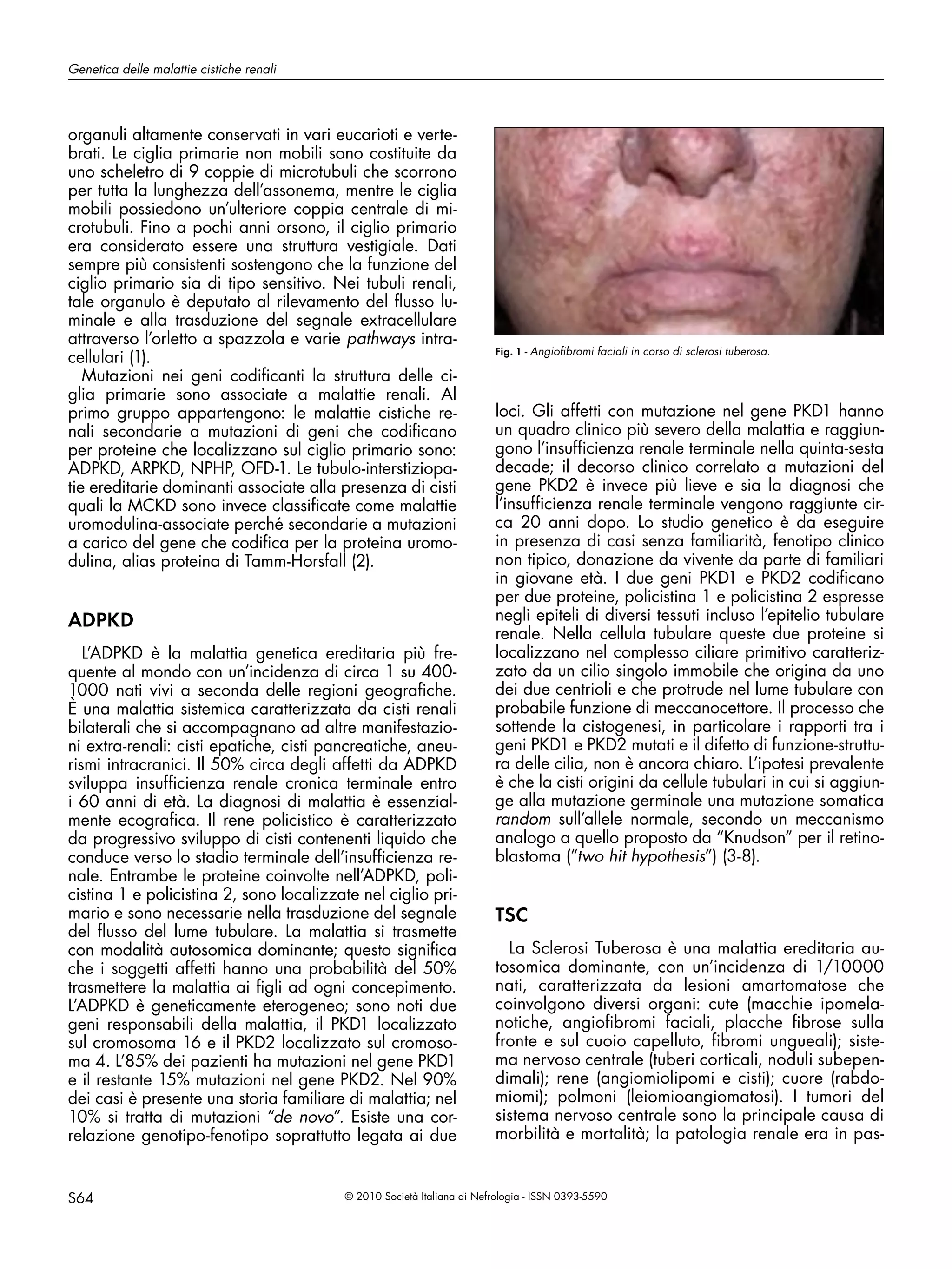Genetica e nosografia delle malattie renali cistiche | PDF