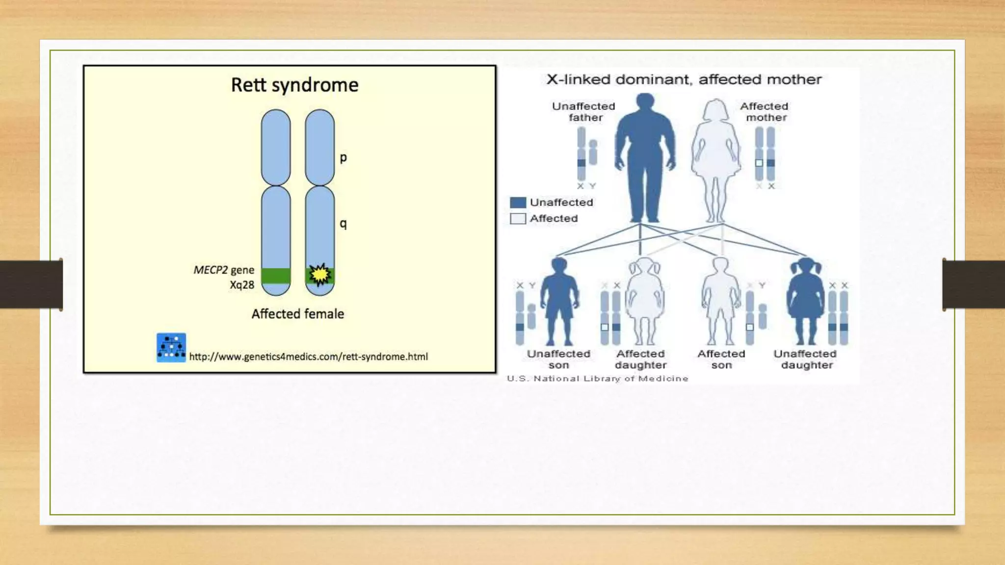 Genetic basis of epilepsy | PPTX