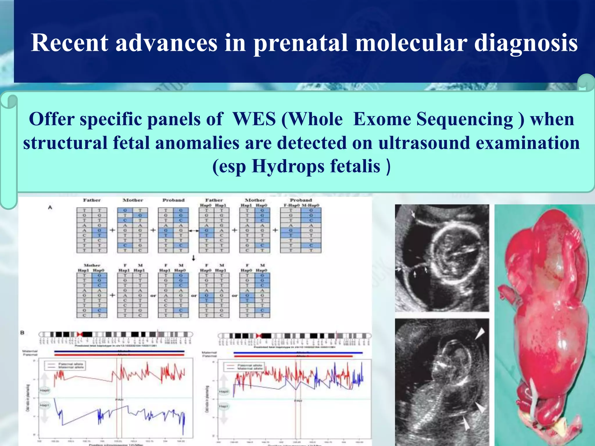 genetic diagnostic approach to malformed fetus .pptx