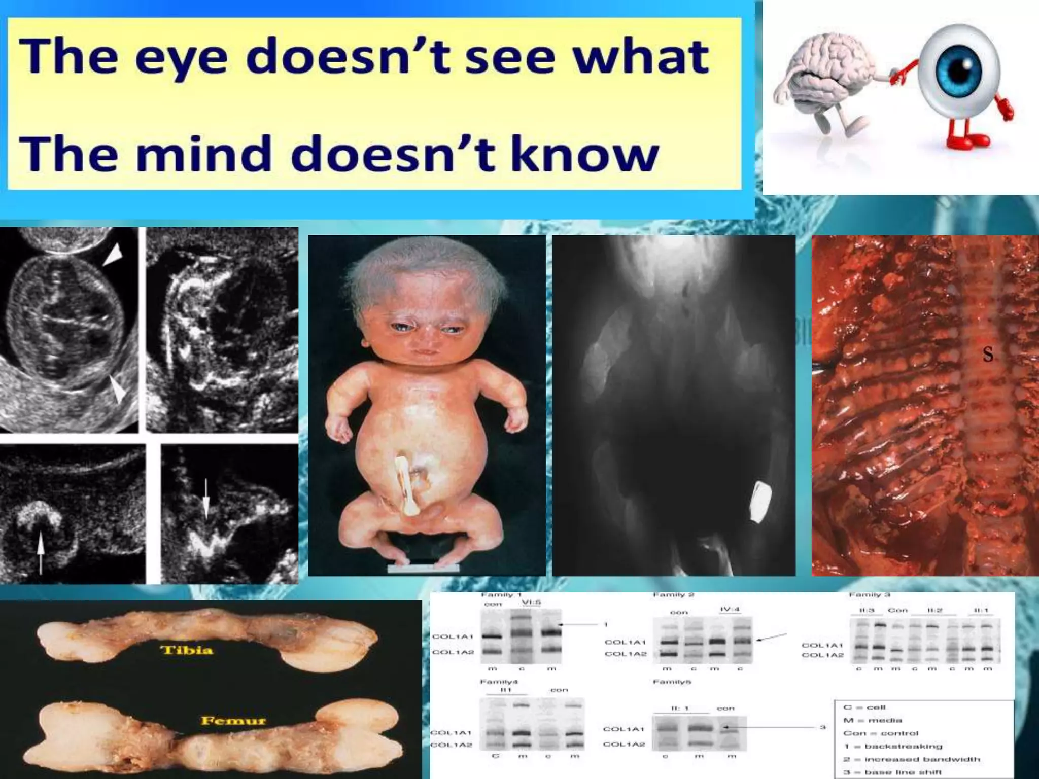 genetic diagnostic approach to malformed fetus .pptx