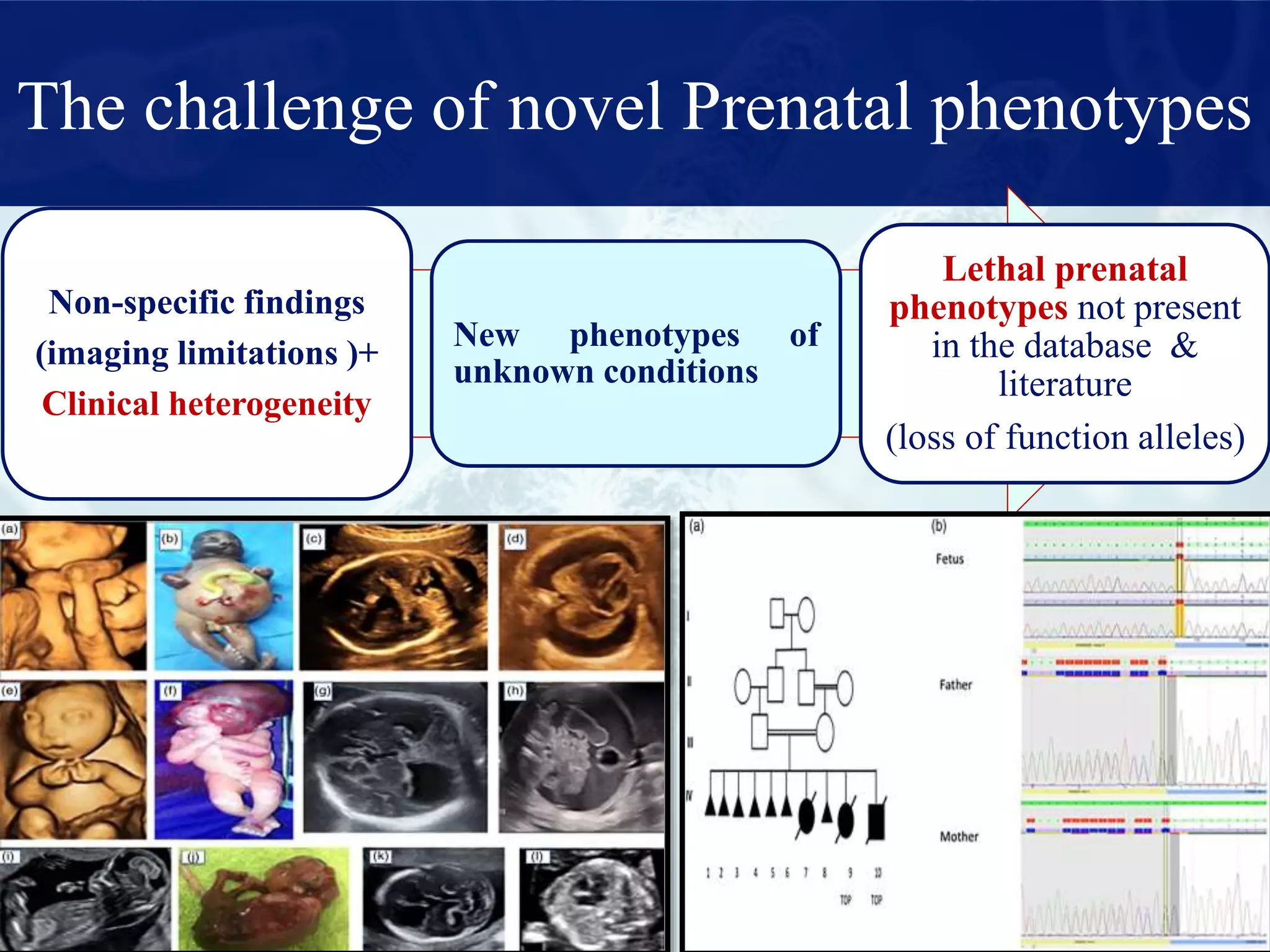 genetic diagnostic approach to malformed fetus .pptx