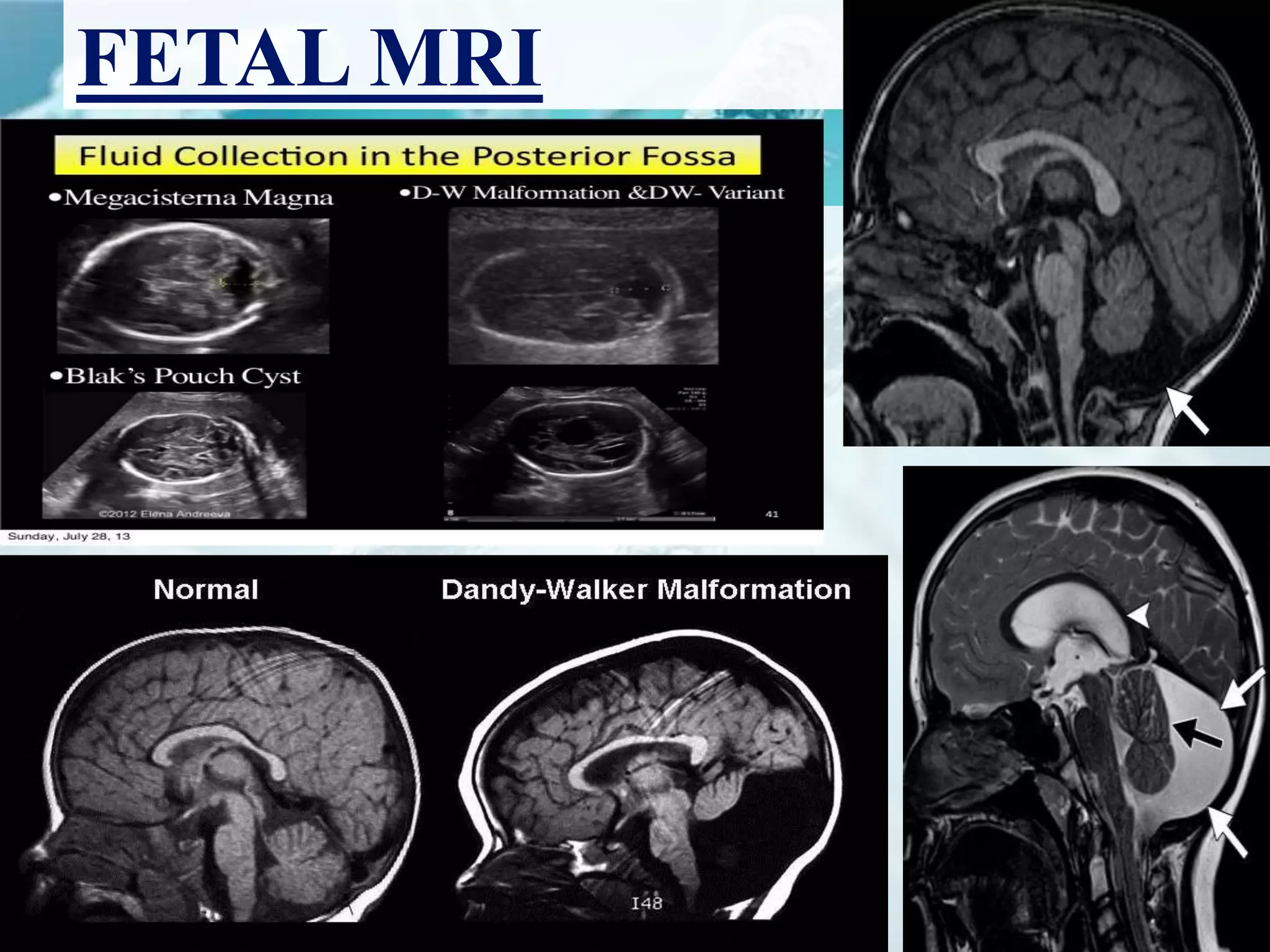 genetic diagnostic approach to malformed fetus .pptx