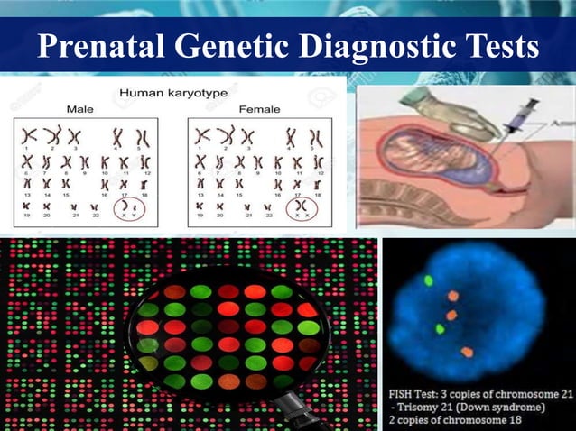 genetic diagnostic approach to malformed fetus .pptx