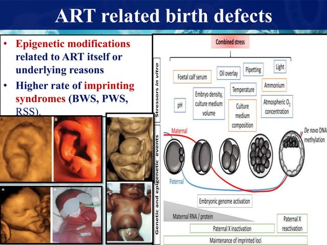 genetic diagnostic approach to malformed fetus .pptx