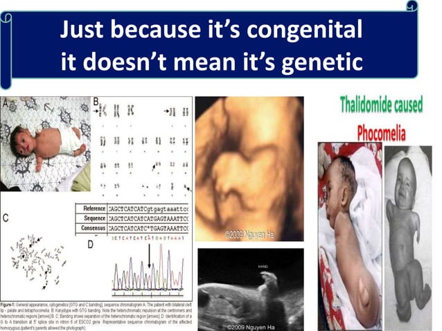 genetic diagnostic approach to malformed fetus .pptx