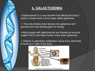 genetic disease by suraj tekam msc 2nd sem. | PPT