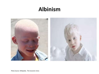 Genetic disorder or Genetically transmitted disease | PPTX