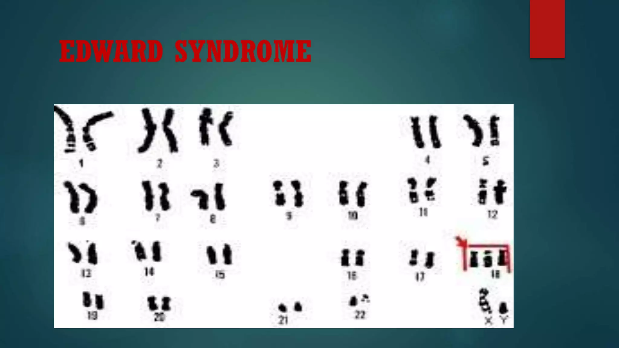 Genetic disorder and Chromosomal abnormalities | PPTX