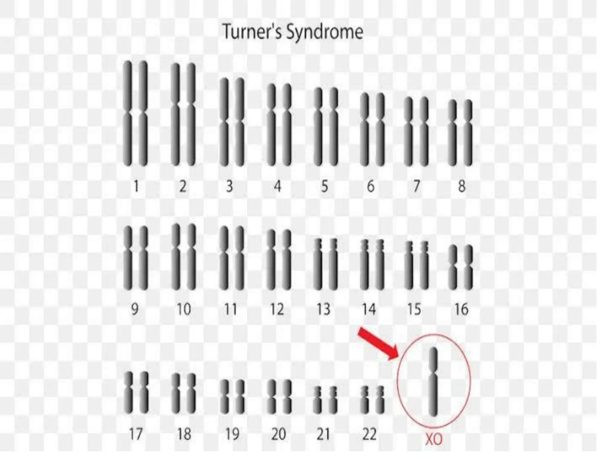 Genetic Disorder Power Point Lecture By Hamid Khan Ppt