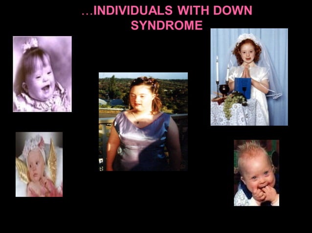 COMMON GENETIC DISORDERS | PPT | Brain and Nervous System Disorders ...