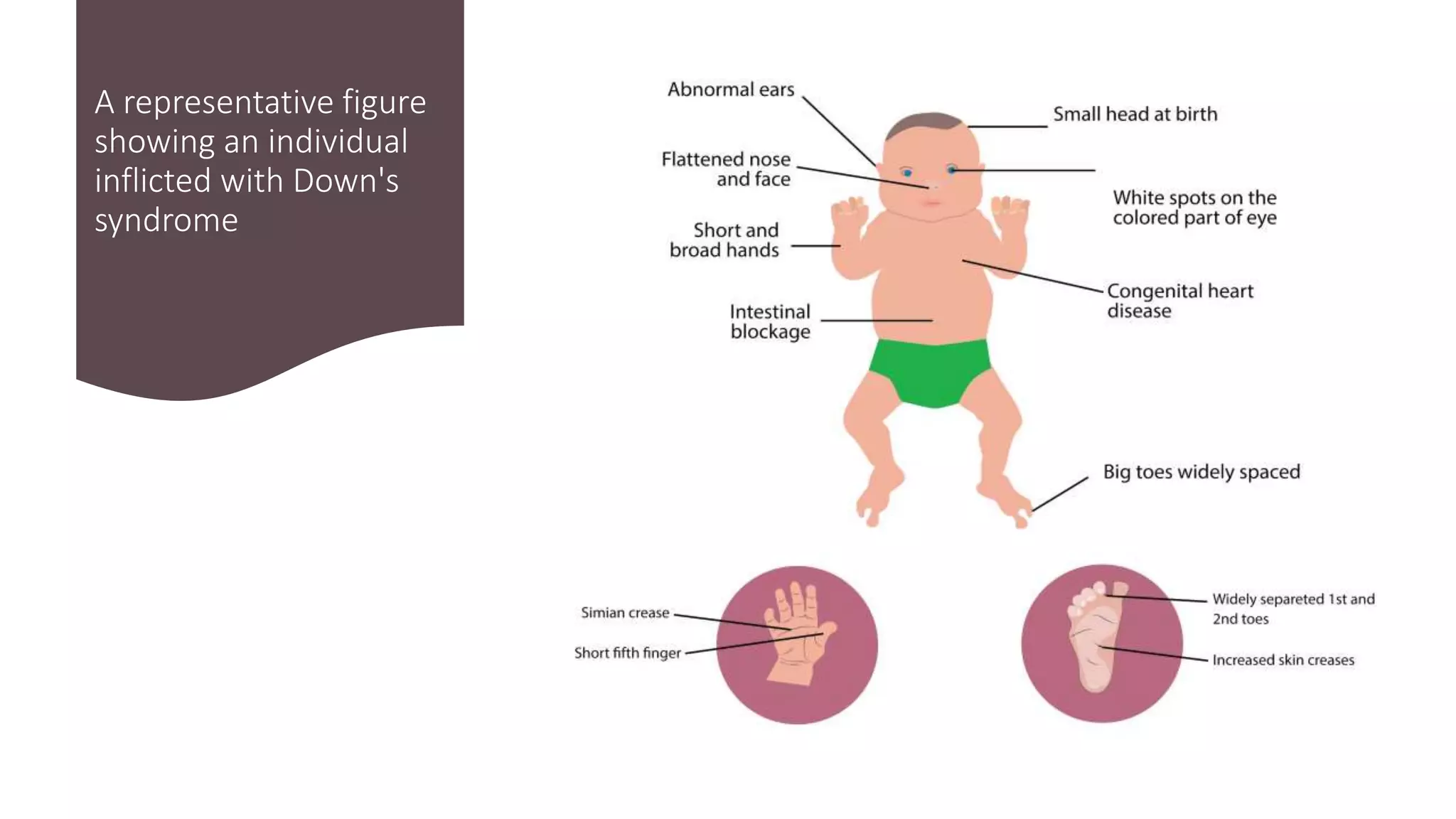Genetic Disorders - Class XII - Biology | PPTX