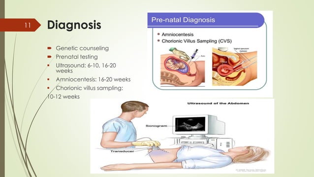 Genetic disorders during prenatal development | PPTX