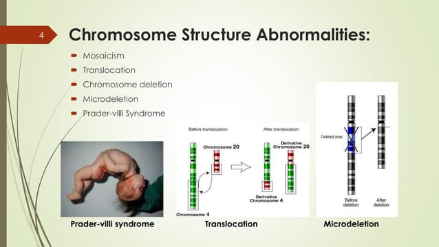 Genetic disorders during prenatal development | PPTX