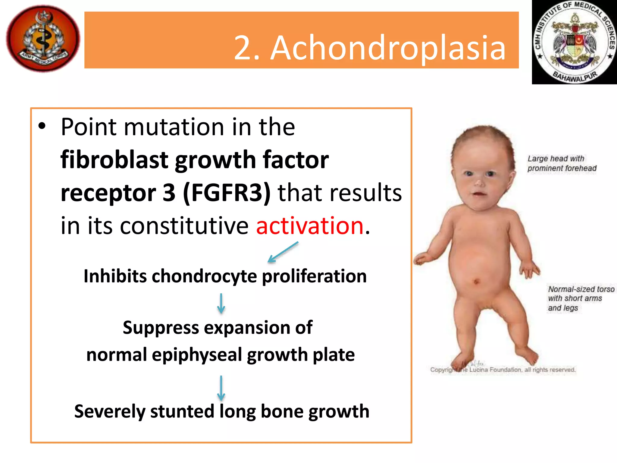 genetic disorders of bone 1.pptx