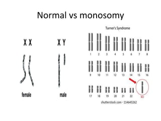 Genetic Disorders ppt.pptx