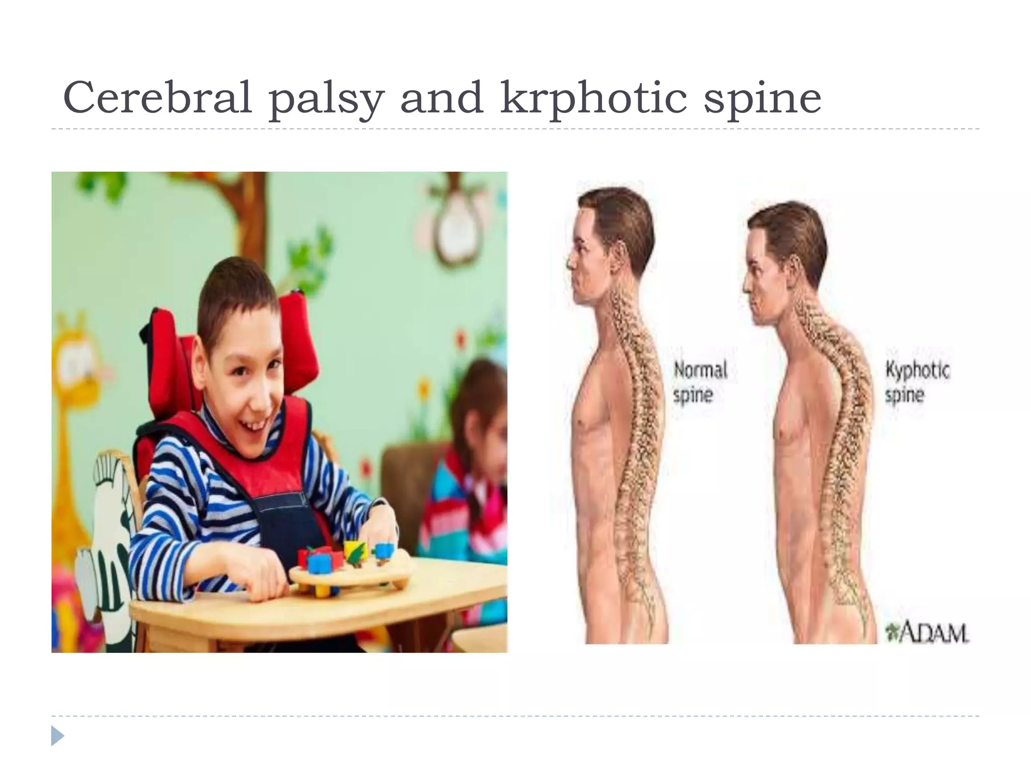 Genetic effects of consanguineous marriage | PPTX