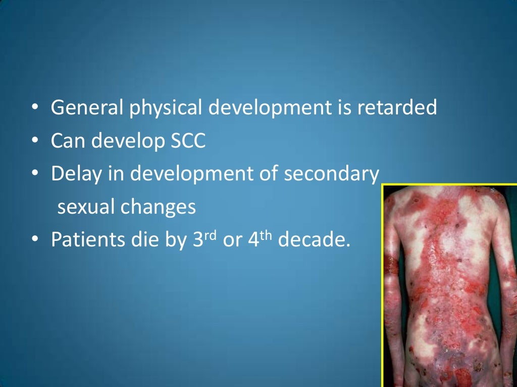 Genetic epidermolysis bullosa