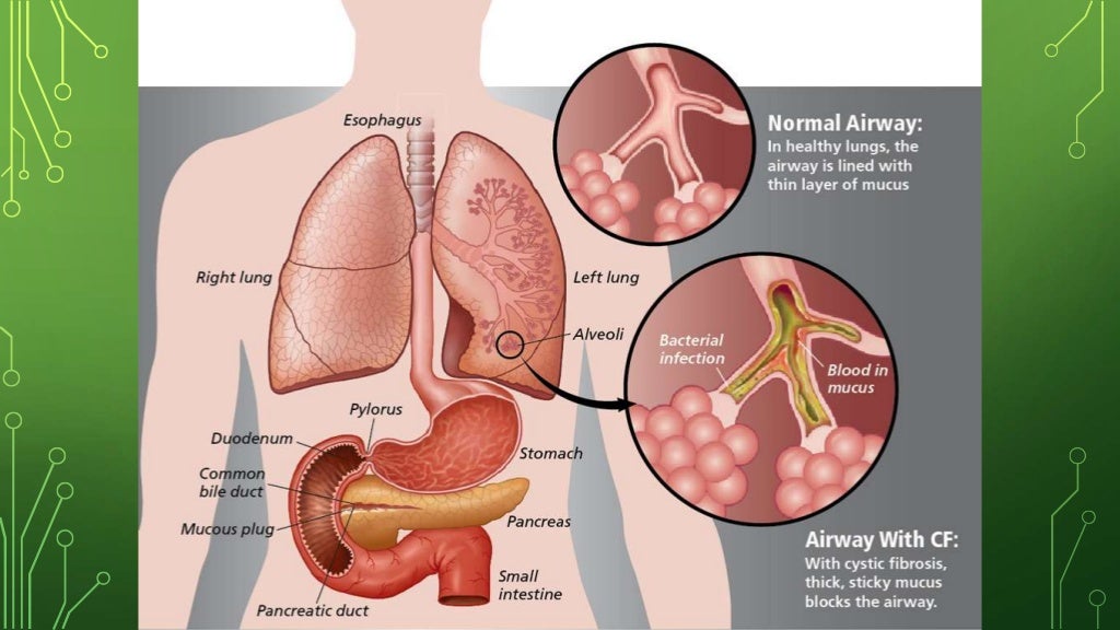 Genetic Pattern Of Common Pediatric Disorder genetic-pattern-of-common-pediatric-disorder