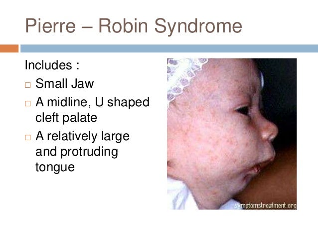 Genetic principles in paediatric surgery