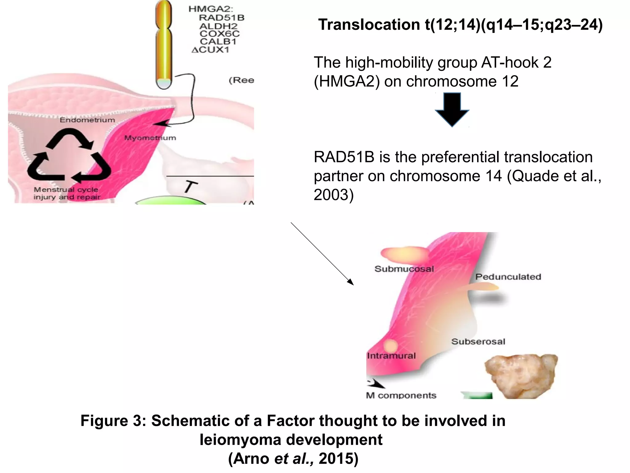 Genetic risk of uterine fibroid and its disparity | ODP