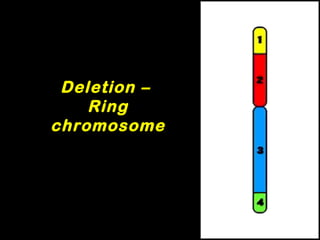 Ring Chromosome