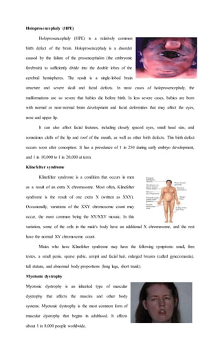 Genetic Diseases | DOCX