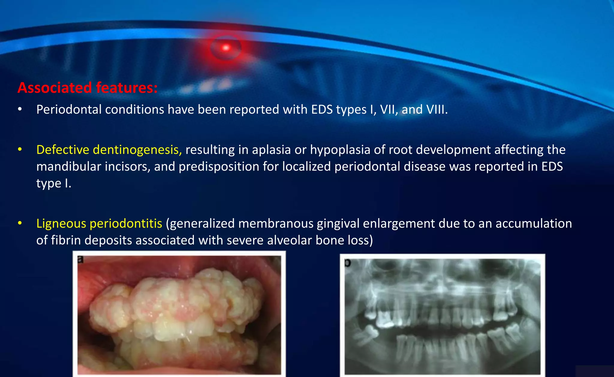 Role of genetics in periodontal diseases | PPTX