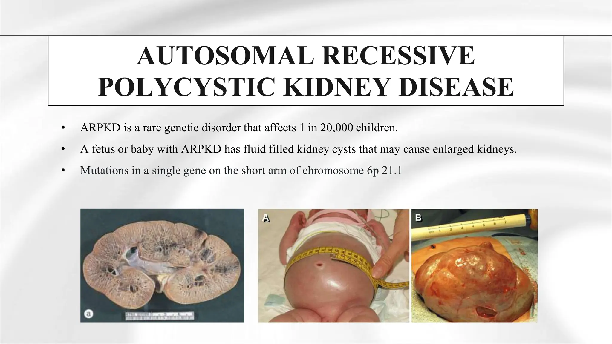 GENETICS and KIDNEY DISEASES / | PPTX