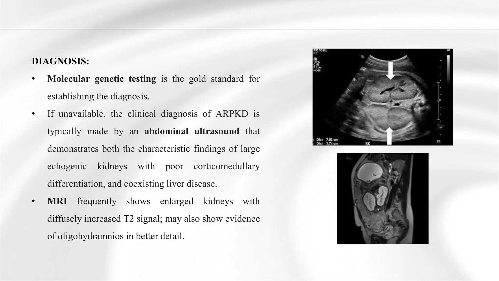 GENETICS and KIDNEY DISEASES / | PPTX