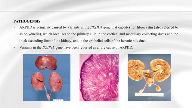 GENETICS and KIDNEY DISEASES / | PPTX