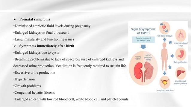 GENETICS and KIDNEY DISEASES / | PPTX