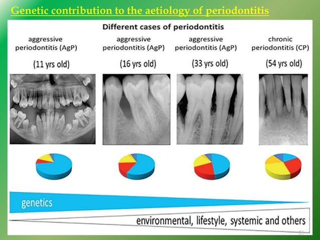 GENETICS AND PERIODONTAL DISEASES | PPTX
