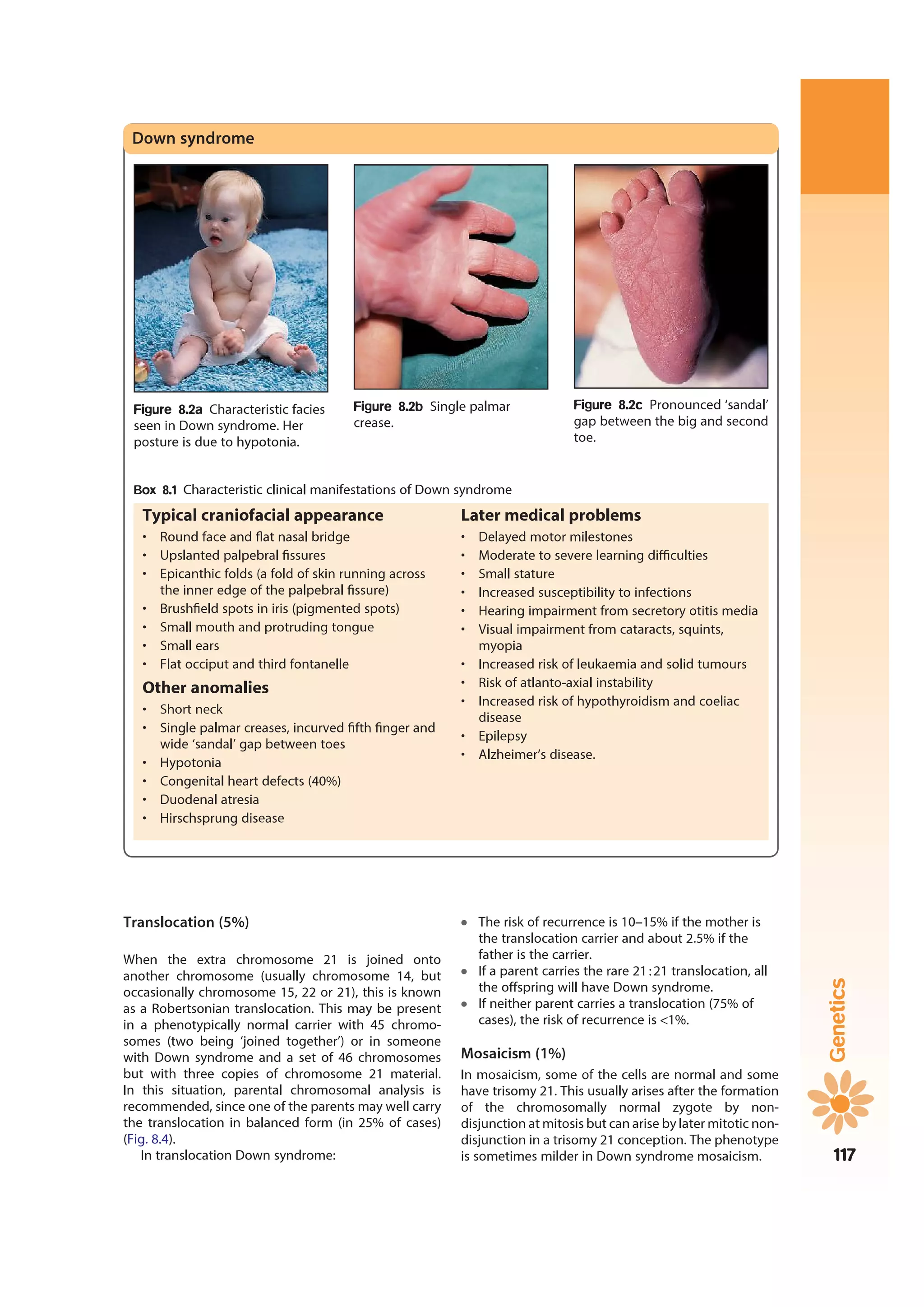 Pediatrics Genetics chapter | PDF