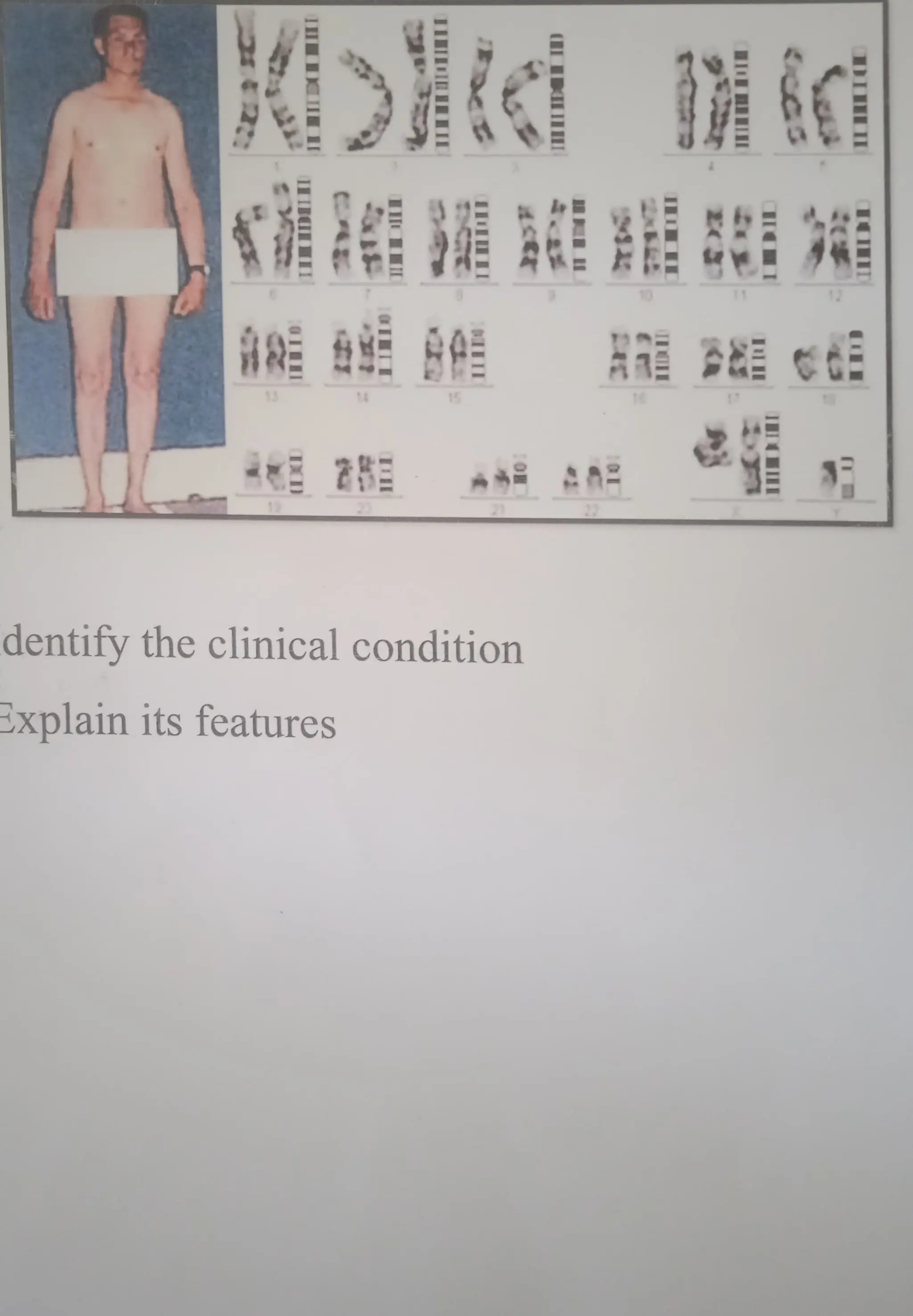 Genetics chart.pdfjdnskskzoxoxdikdkslszo | PDF