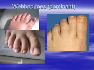 Genetics examples | PPTX