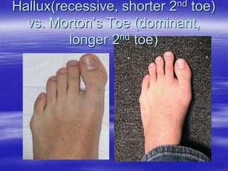 Genetics examples | PPTX