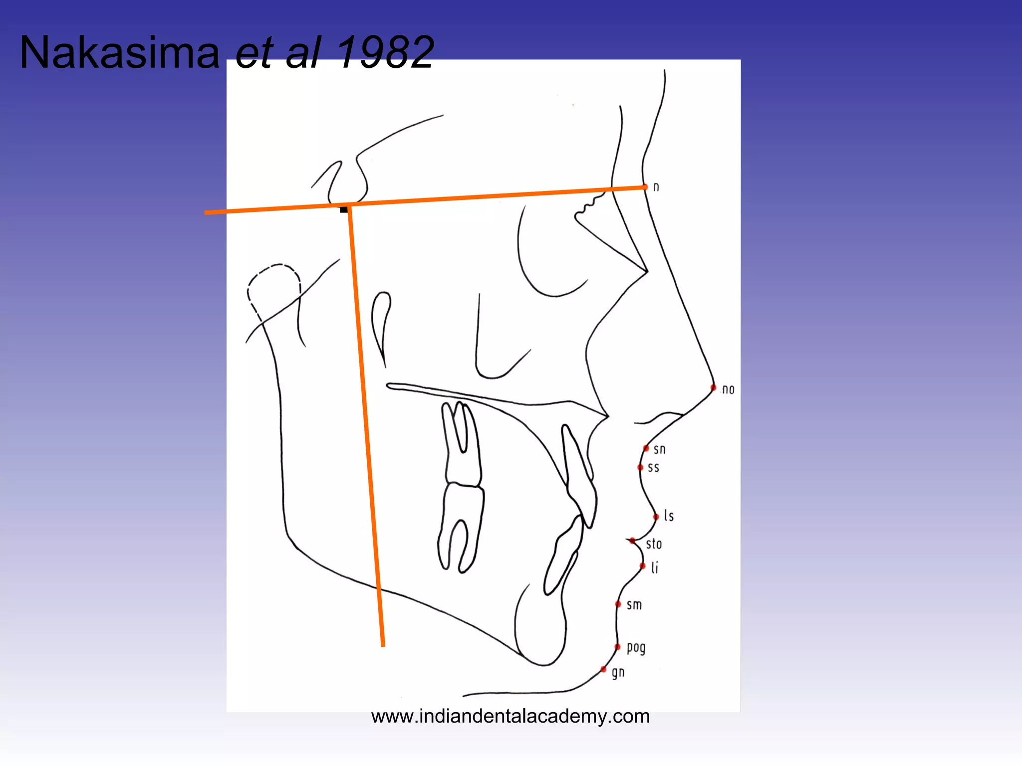 Genetics factor in development of malocclusion | PPT