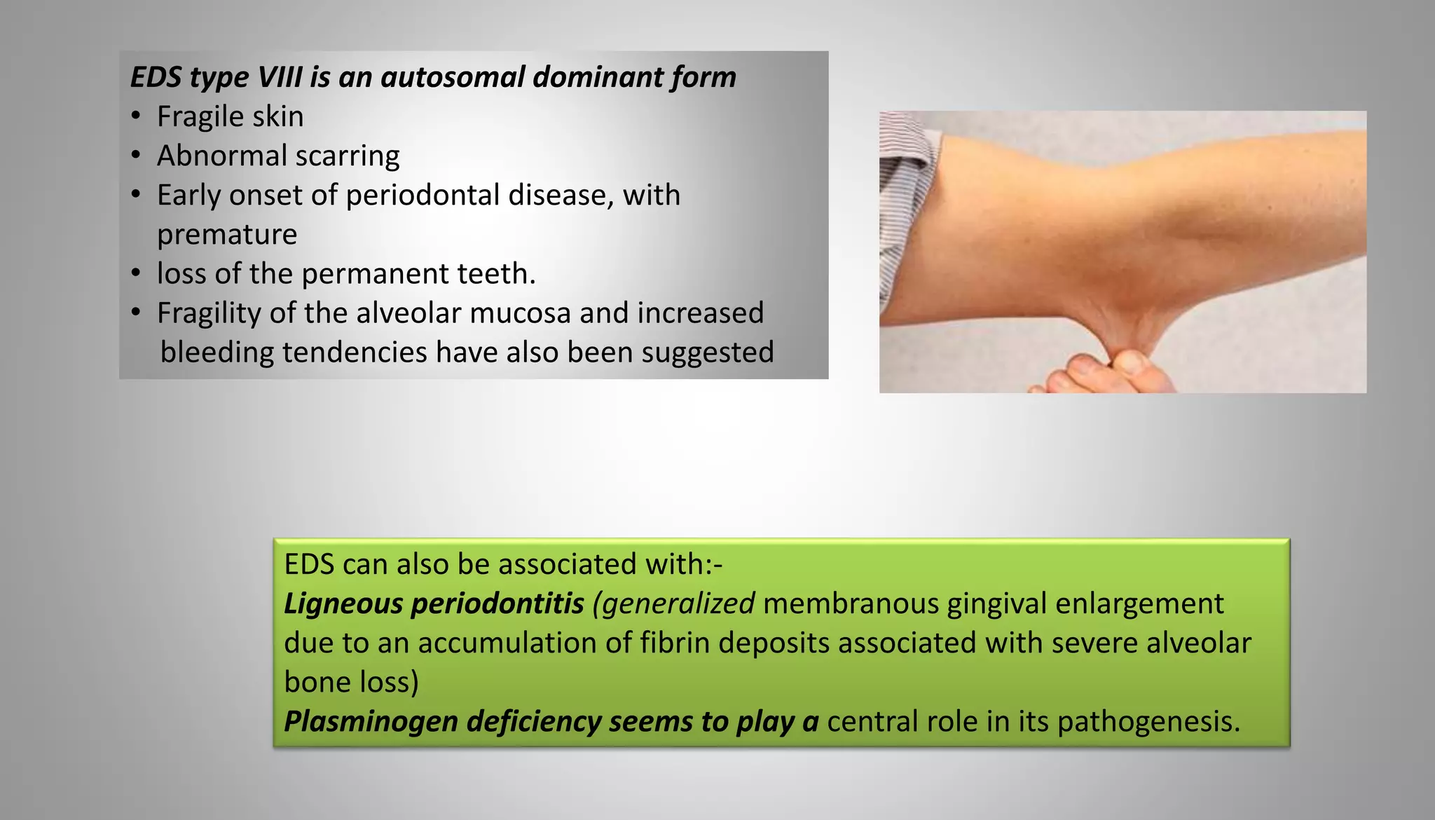 GENETICS IN PERIODONTICS SEMIAR..pptx
