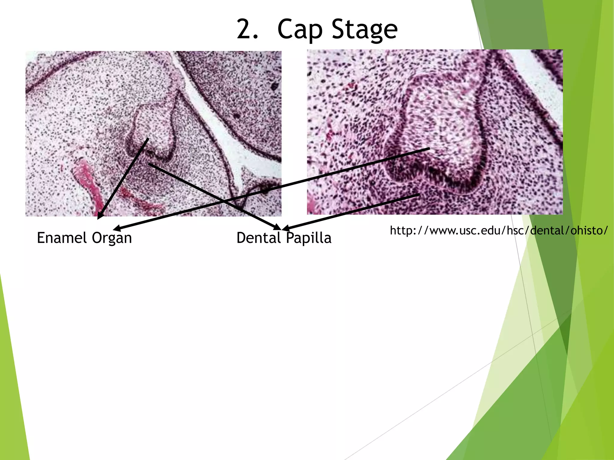 Genetics in tooth development | PPTX