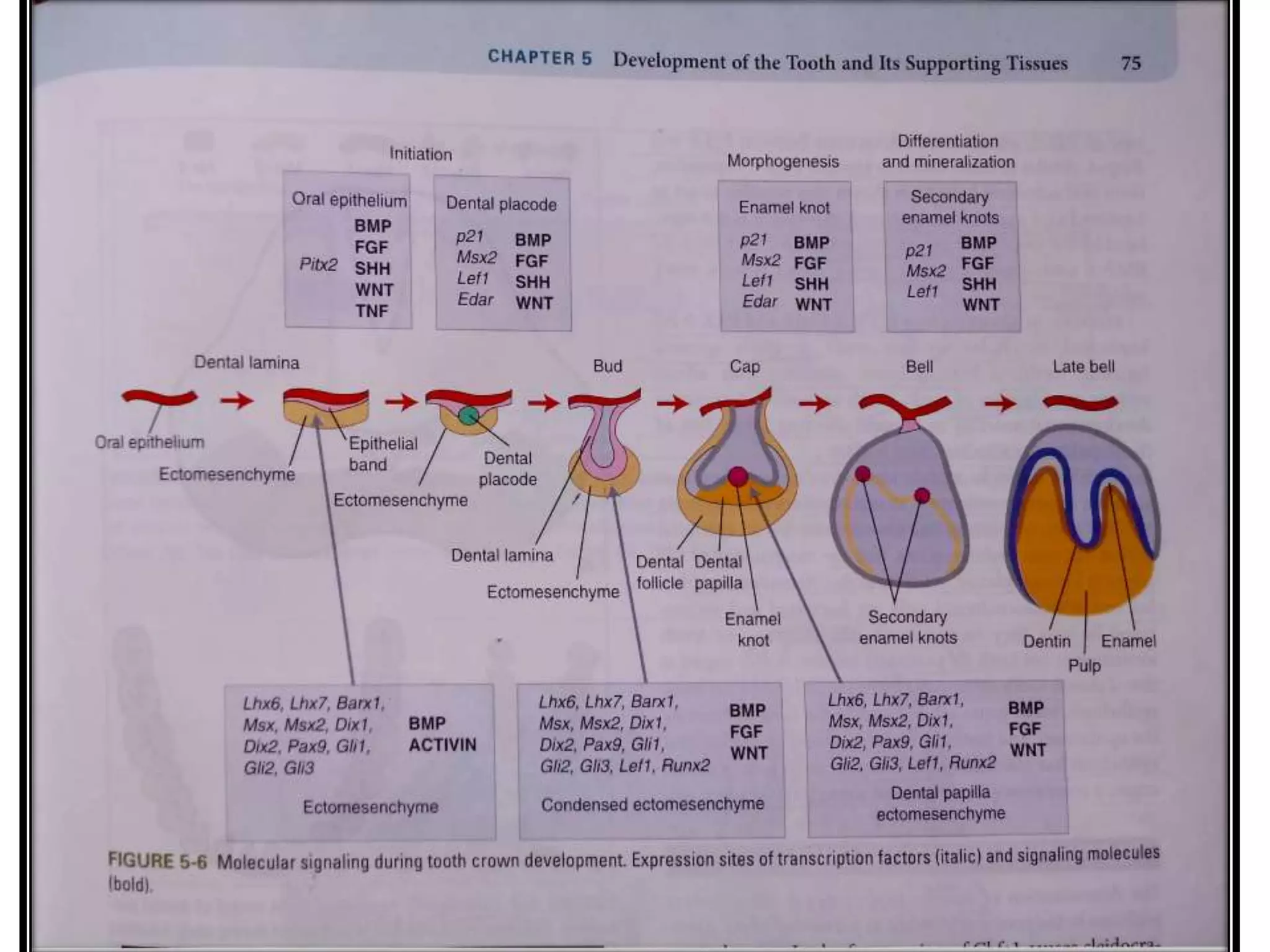 Genetics in tooth development - Copy.pptx
