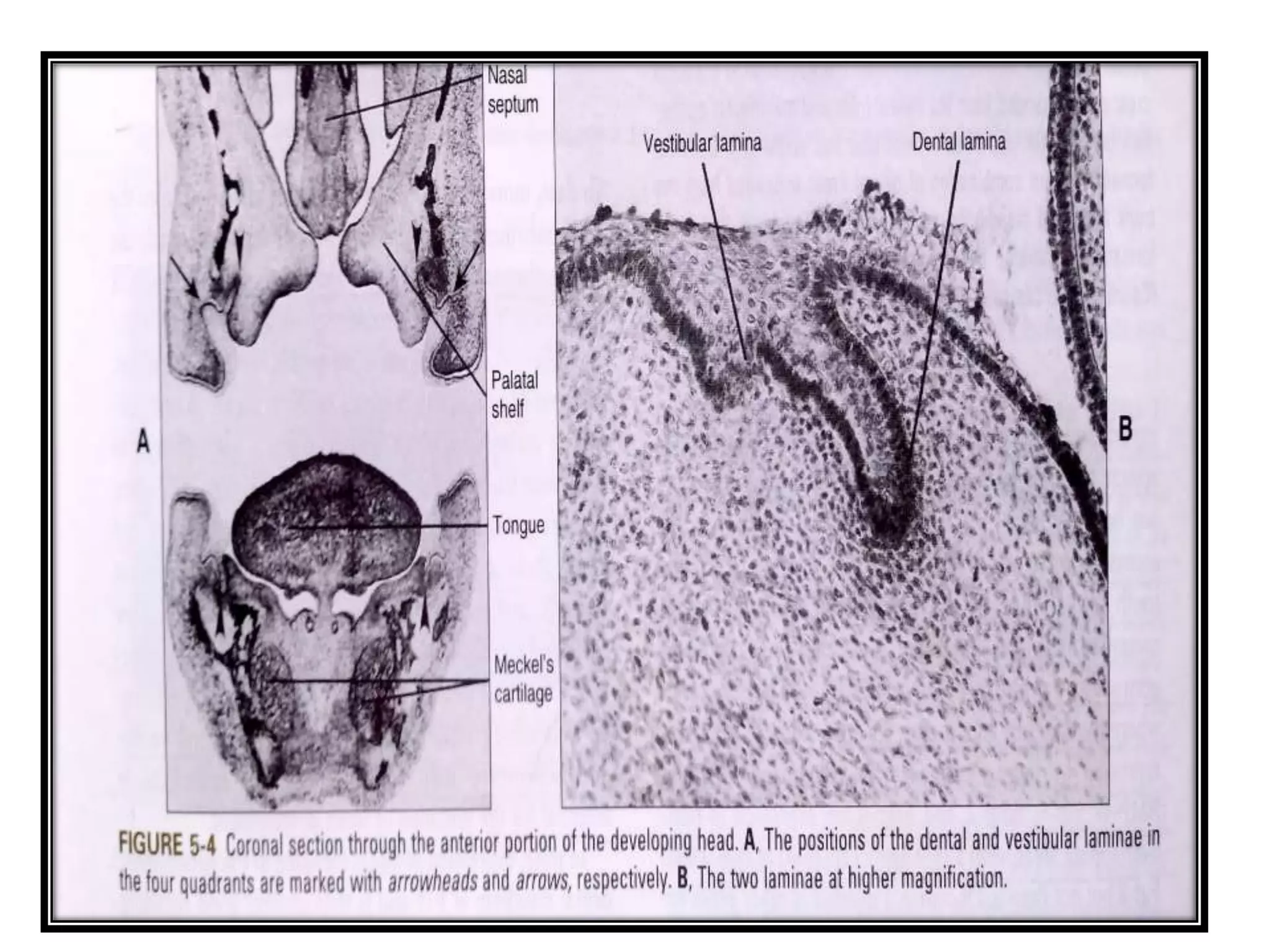 Genetics in tooth development - Copy.pptx