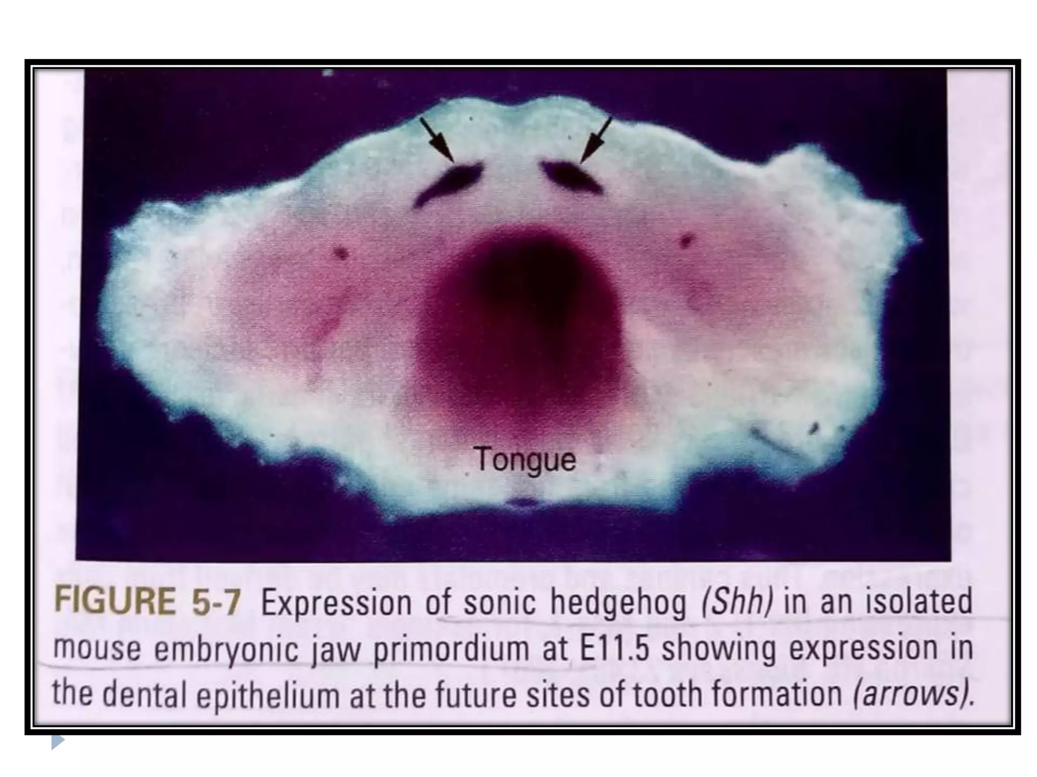 Genetics in tooth development - Copy.pptx