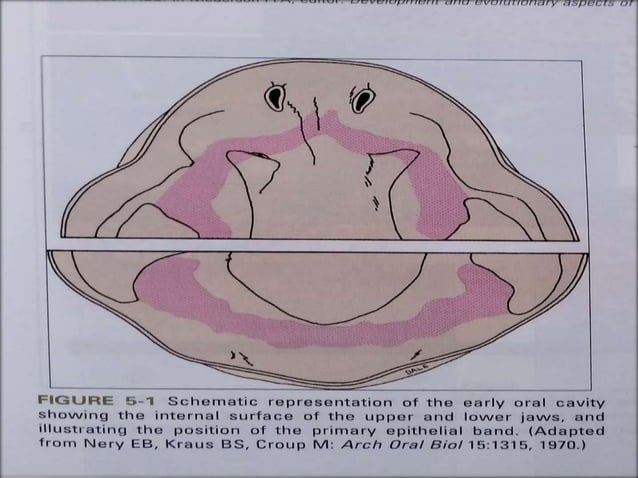 Genetics in tooth development - Copy.pptx | Dental Health | Diseases ...