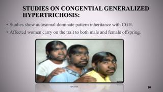 Genetics of congenital generalized hypertrichosis | PPTX