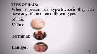 Genetics of congenital generalized hypertrichosis | PPT