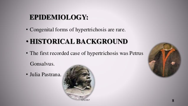 Genetics Of Congenital Generalized Hypertrichosis