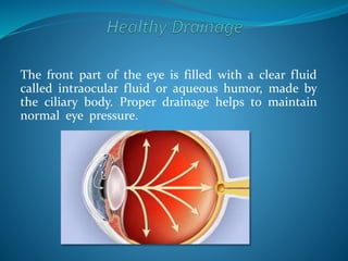 Genetics of glaucoma | PPTX